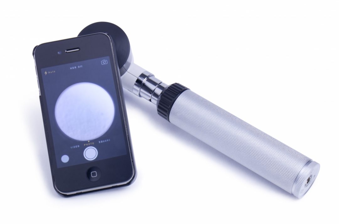 iphone Adaptors for OPTICLAR Dermatoscopes - Dermatology, Dermatoscopes ...