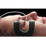 The Morgan Lens - Emergency Care, Emergency Eyecare - Albert Waeschle