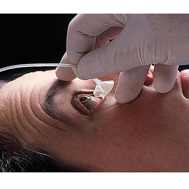 The Morgan Lens - Emergency Care, Emergency Eyecare - Albert Waeschle